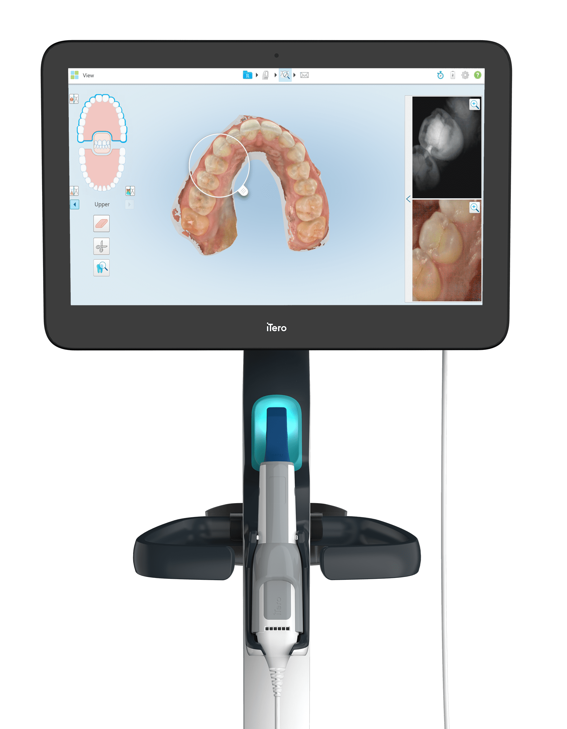 Itero Digital Imaging Traverse City Beulah MI | Up North Orthodontics